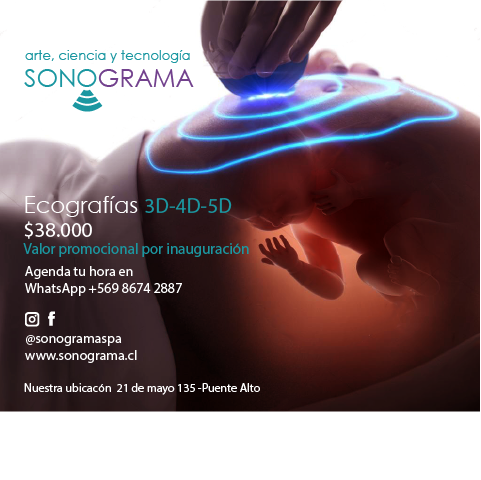 Sonograma | Ultrasonido
